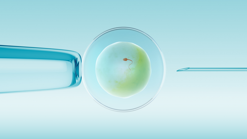 SCSA & DFI Testing in Male Fertility - Choosing the Right Treatment
